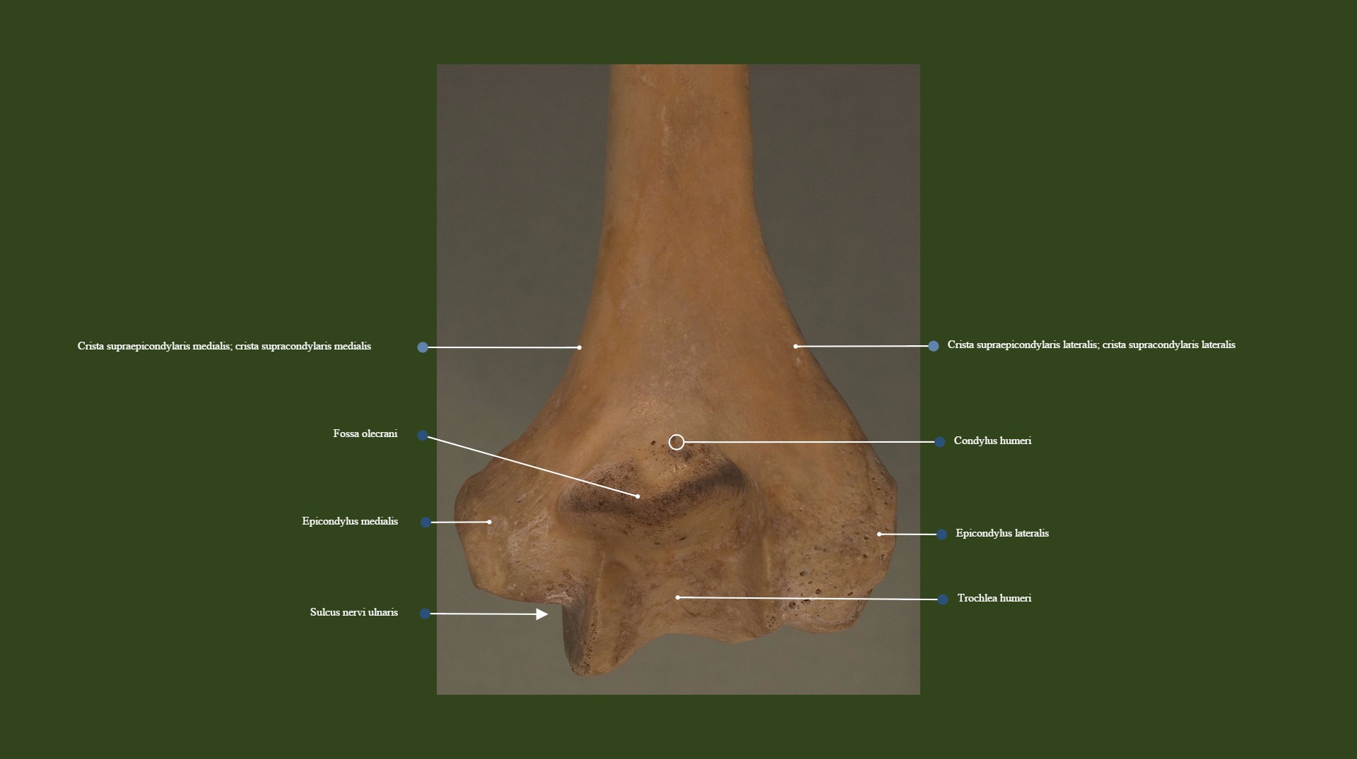 Epicondylus Humeri Causes Of Elbow Pain | Elbow Treatment Jayanagar